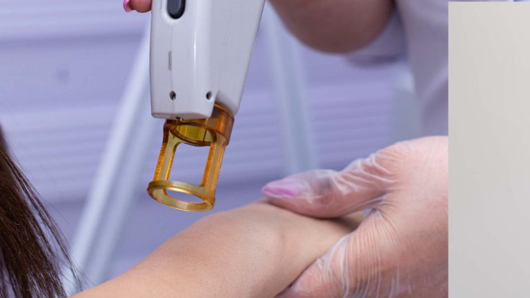 10 Benefits of Laser Hair Removal Over Waxing & Shaving | Dubai