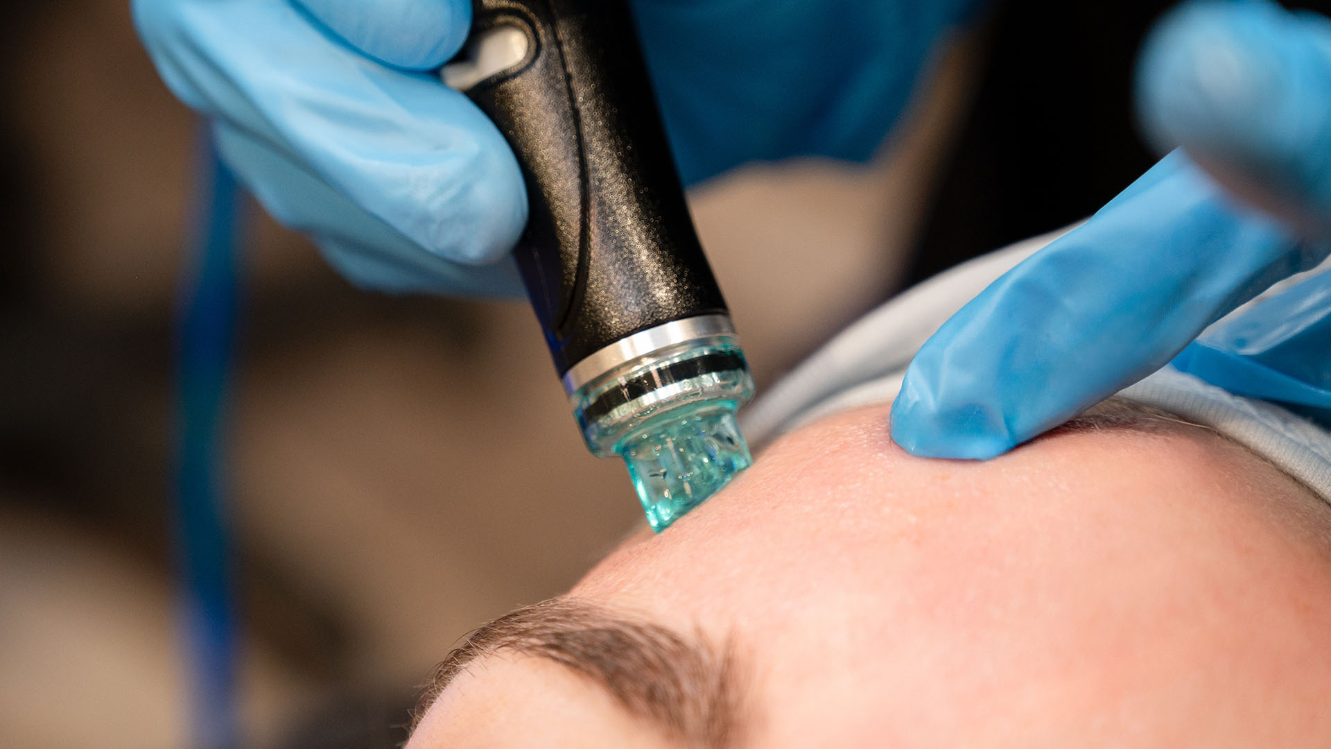 Manual Extraction Facial in Dubai: Why They Matter
